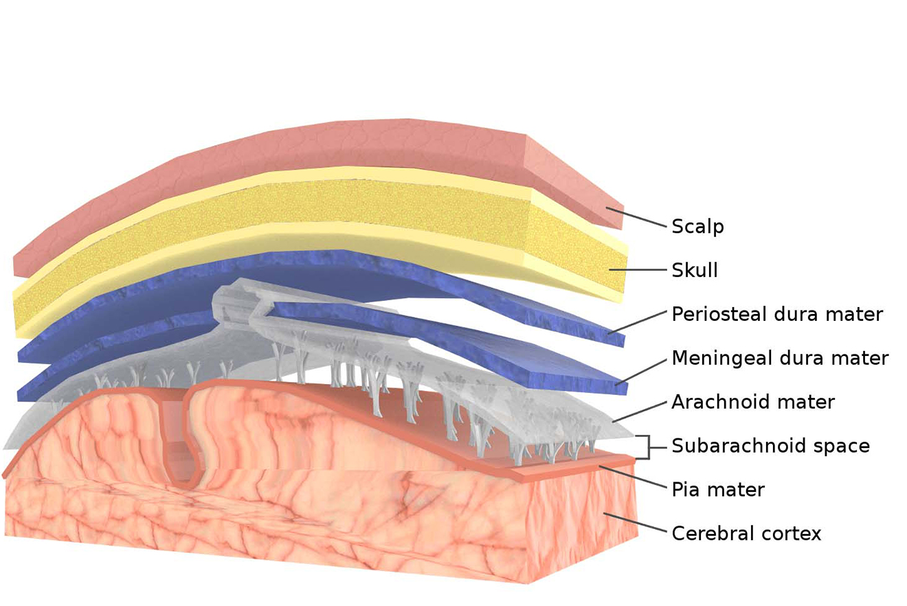 Arachnoiditis | Diagnosis, Causes, Treatment - Pure Medical