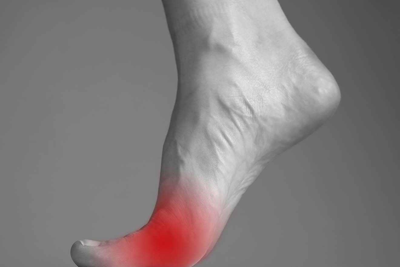 Foot Pain | Arches, Ball, Heel, Toes, Causes & Treatment - Pure Medical