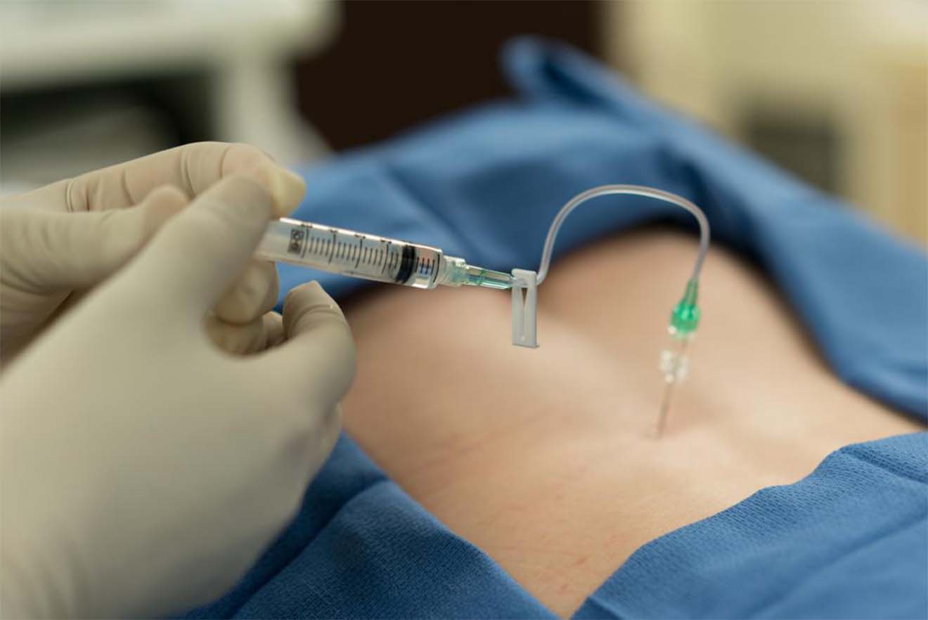 Arachnoiditis | Diagnosis, Causes, Treatment - Pure Medical