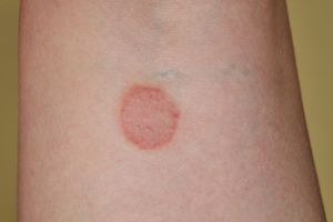 13 of the Most Common Child Skin Problems | Identify the Cause - Pure ...