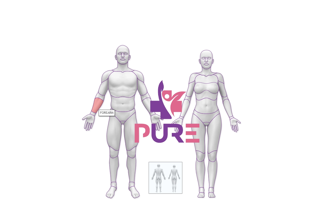 Forearm Conditions - Pure Medical