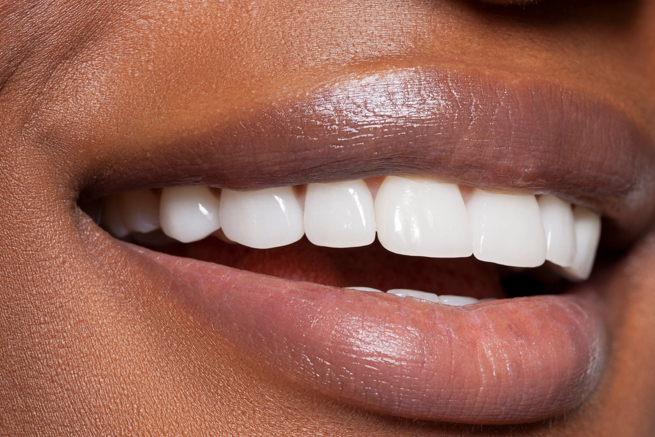 18 Ways to Maintain Good Healthy Teeth | Tips for Effective Brushing ...